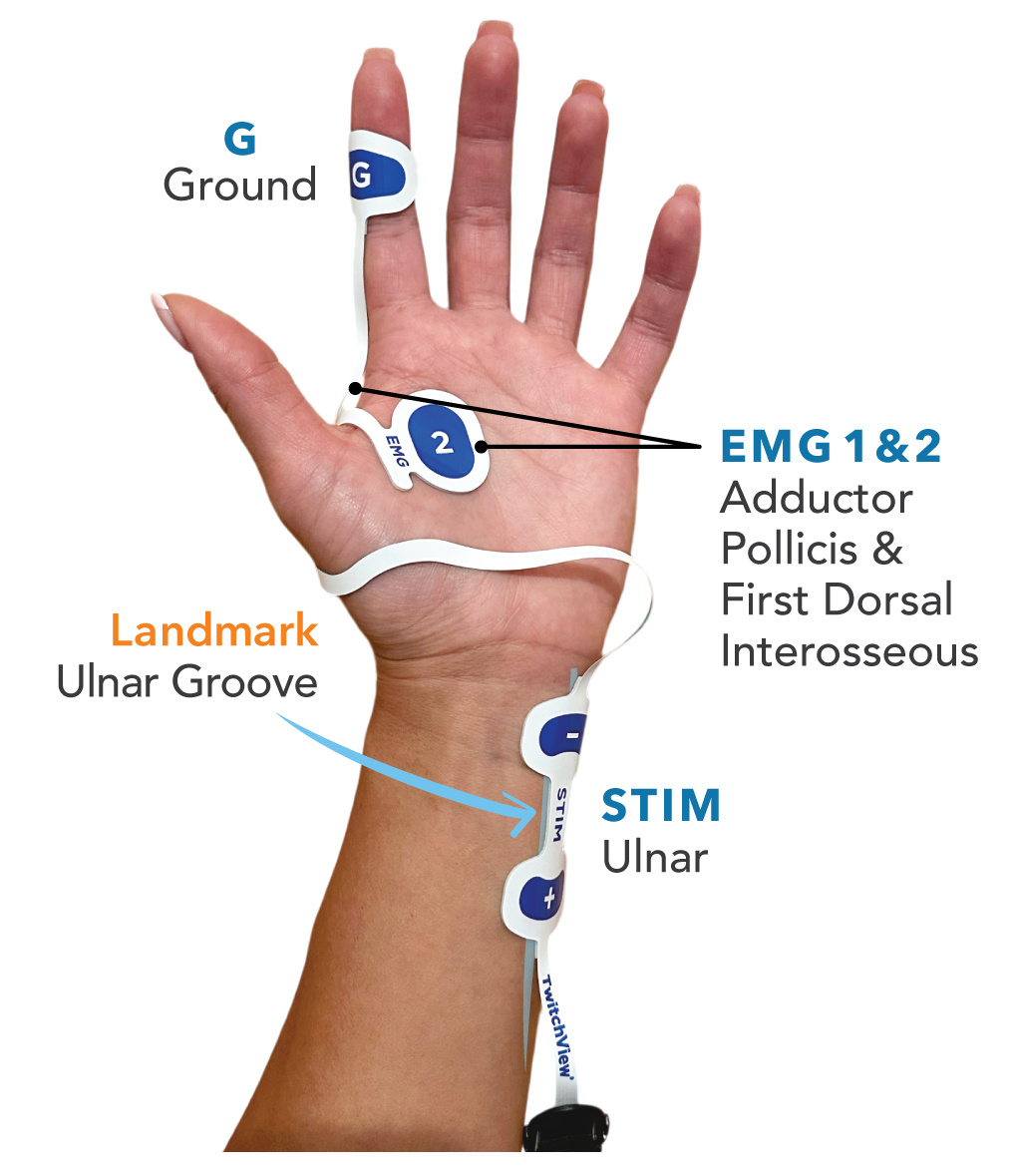 TwitchView User Guide