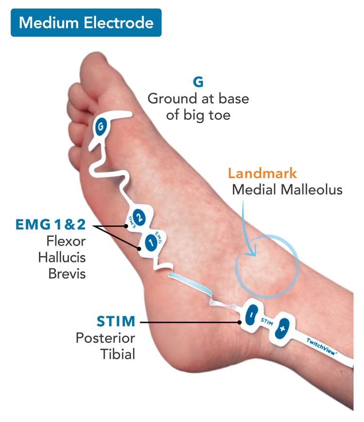 TwitchView User Guide