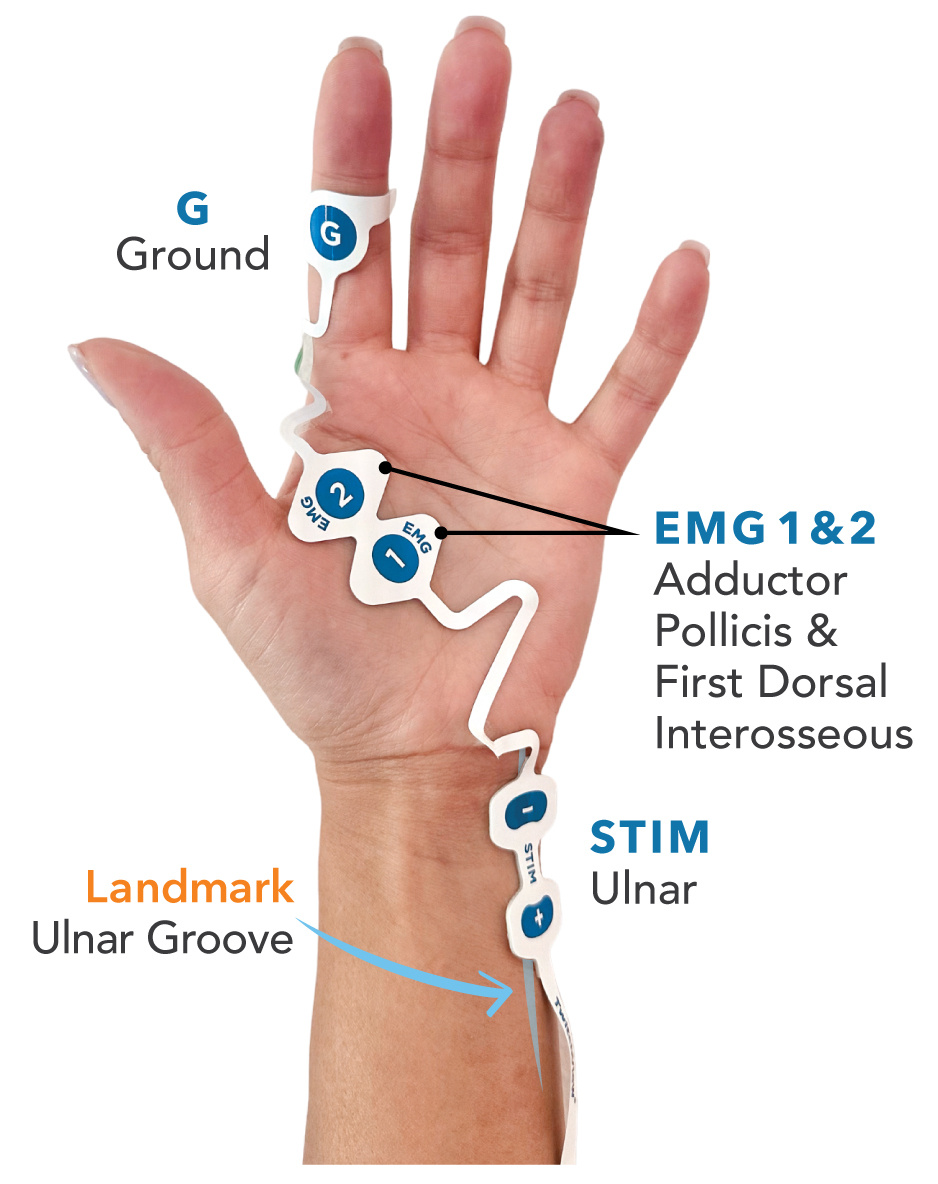 Guia do utilizador do TwitchView