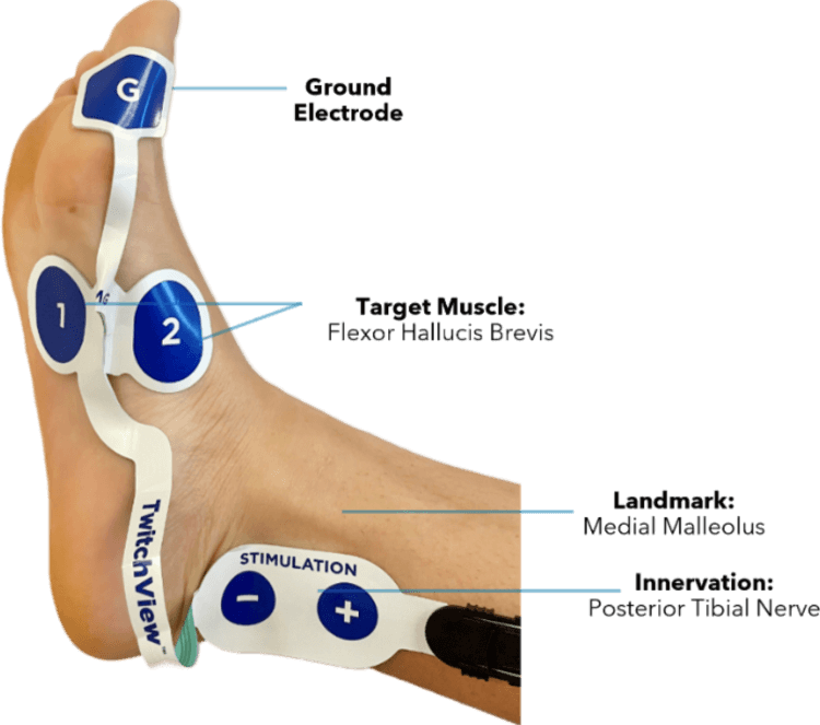 TwitchView User Guide