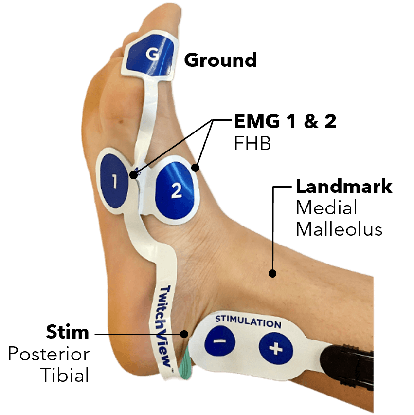 TwitchView User Guide