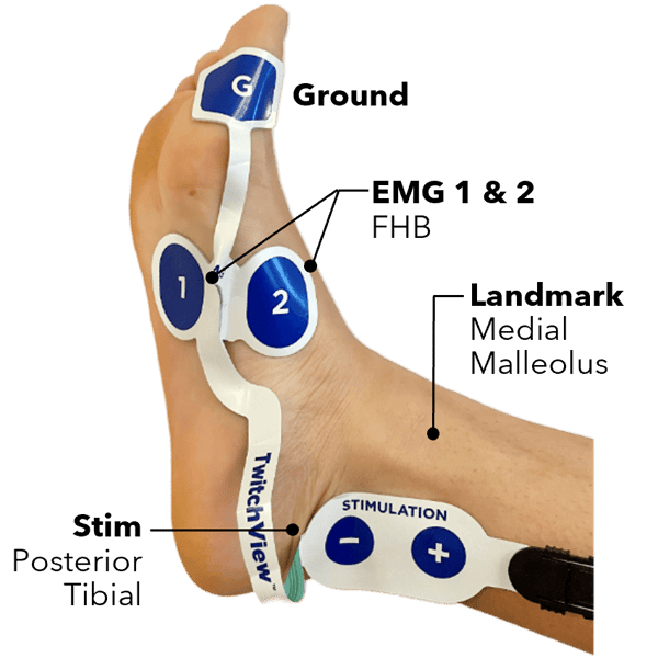 TwitchView User Guide