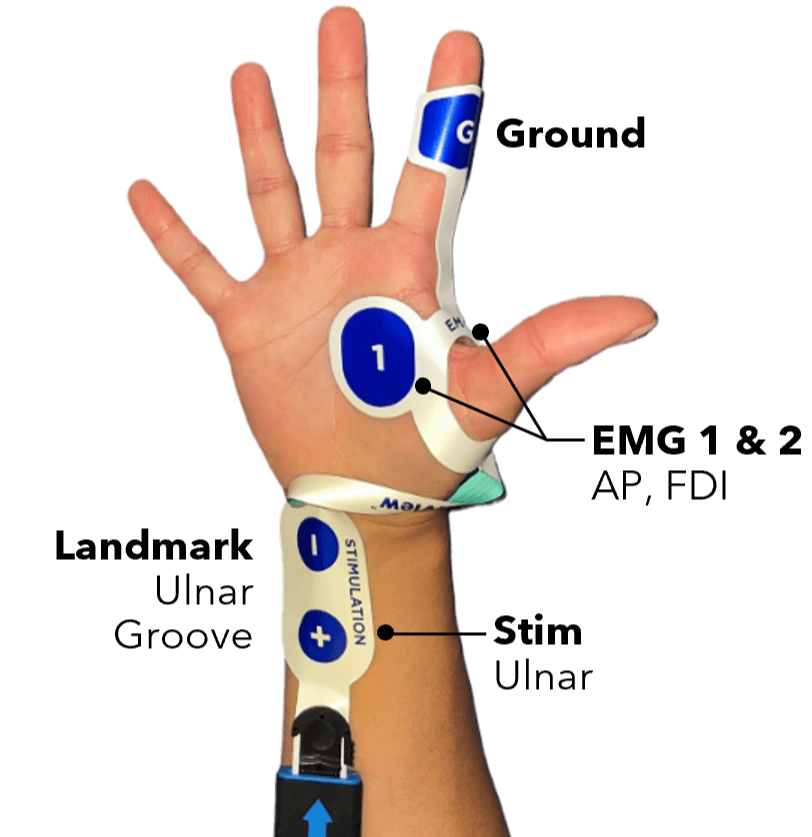 TwitchView User Guide