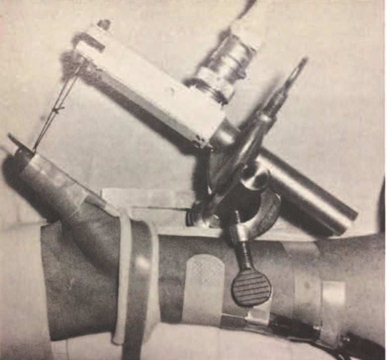 How to Pick the Best Quantitative Neuromuscular Monitoring Device for ...