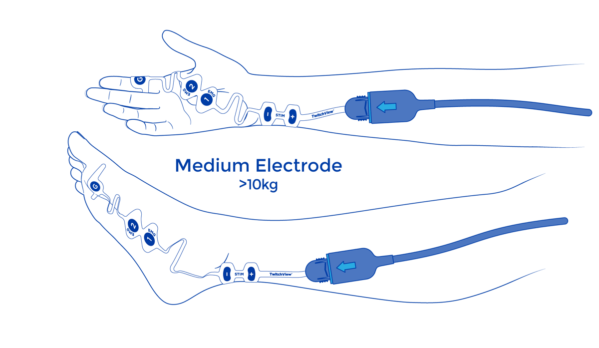TwitchView2 | Quantitative Neuromuscular Blockade Monitor