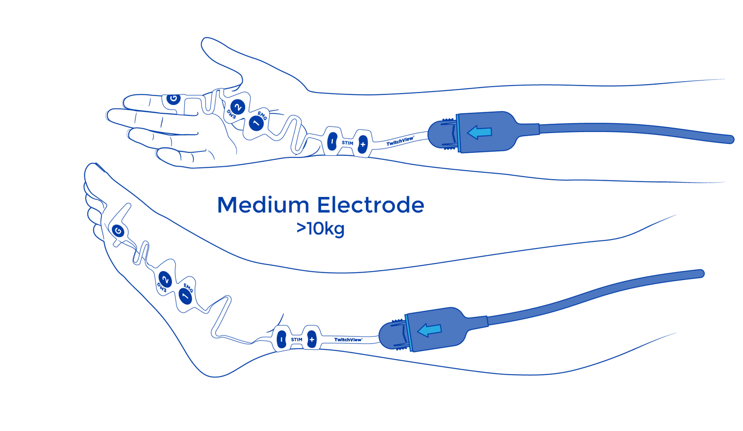 TwitchView2 | Quantitative Neuromuscular Blockade Monitor