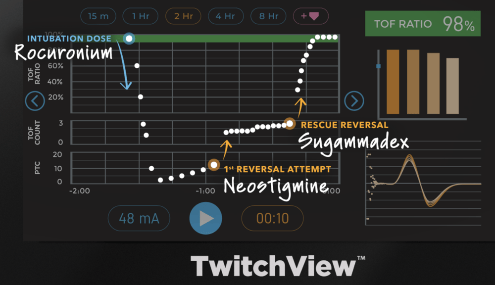 How to Pick the Best Quantitative Neuromuscular Monitoring Device for ...