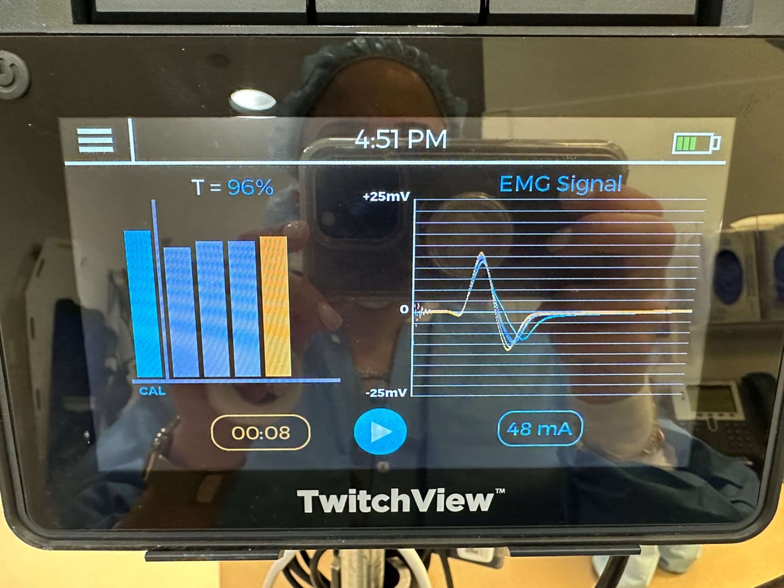 How to Monitor Succinylcholine-Induced Neuromuscular Blockade