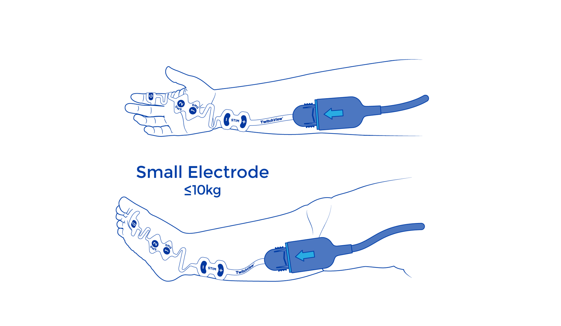 TwitchView2 | Quantitative Neuromuscular Blockade Monitor