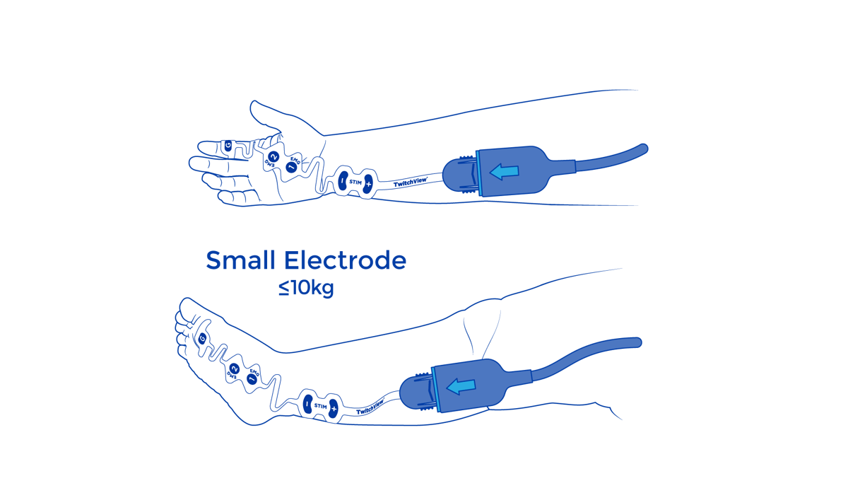 TwitchView2 | Quantitative Neuromuscular Blockade Monitor