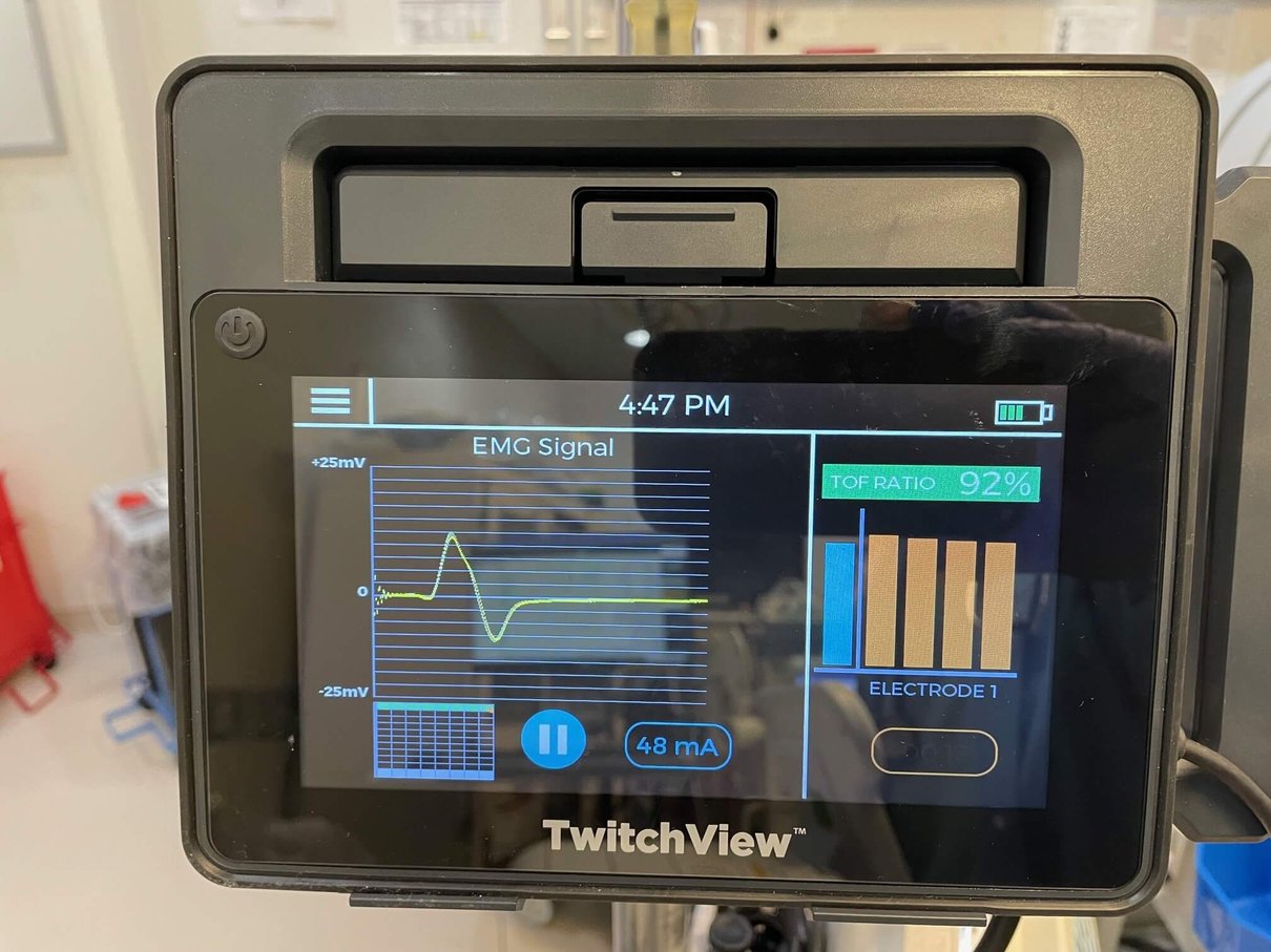 How to Monitor Succinylcholine-Induced Neuromuscular Blockade
