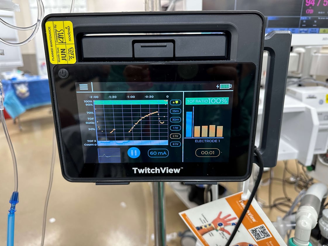 How to Implement the ASA Practice Guidelines for Neuromuscular Blockade