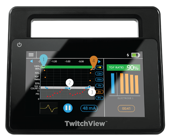 TwitchView Quantitative Neuromuscular Blockade Monitor