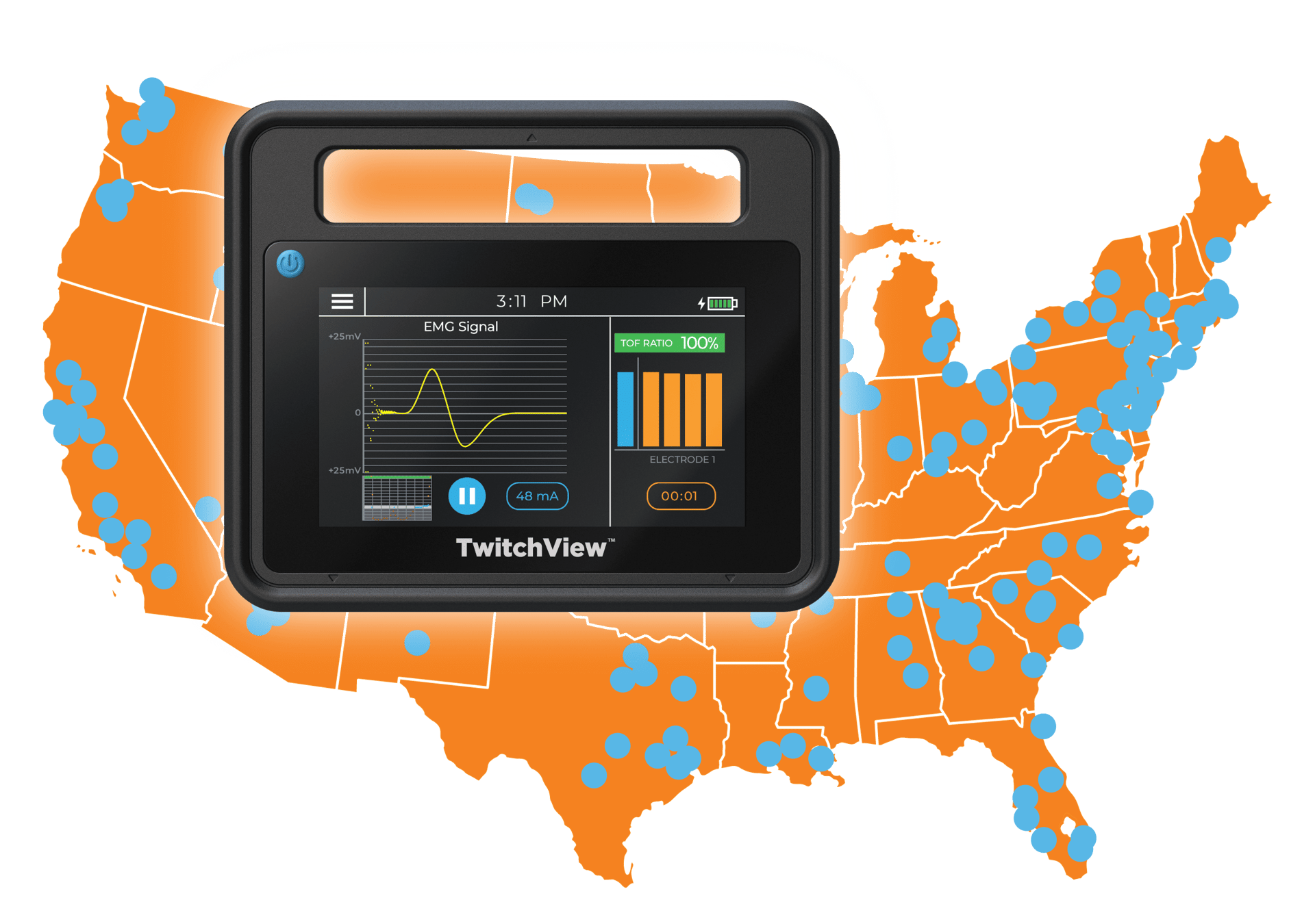 Quantitative Neuromuscular Monitor for Neuromuscular Blockade