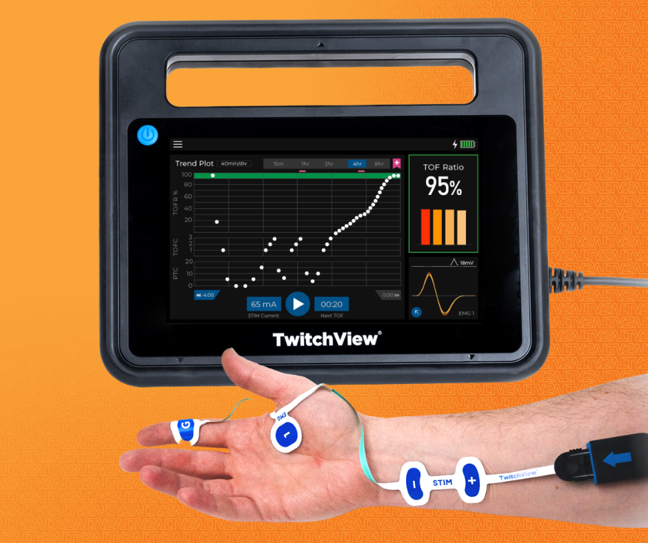 Electrode Placement: The Foundation of Reliable Neuromuscular Monitoring